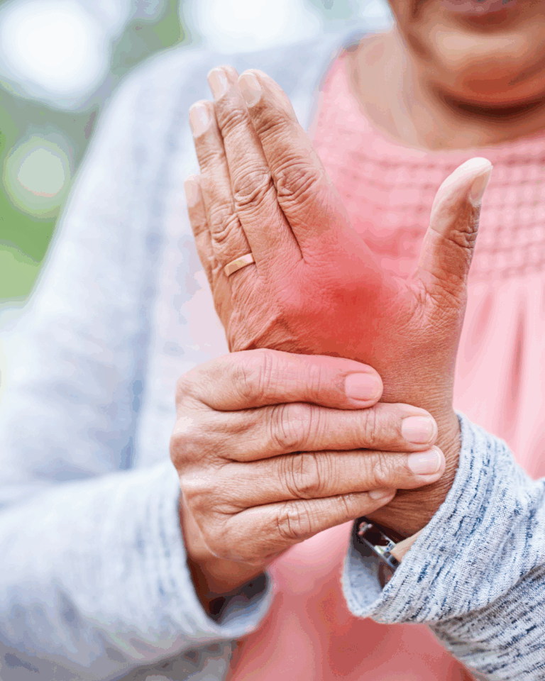 Hand pain in your 40s? Perimenopause might be the cause.
